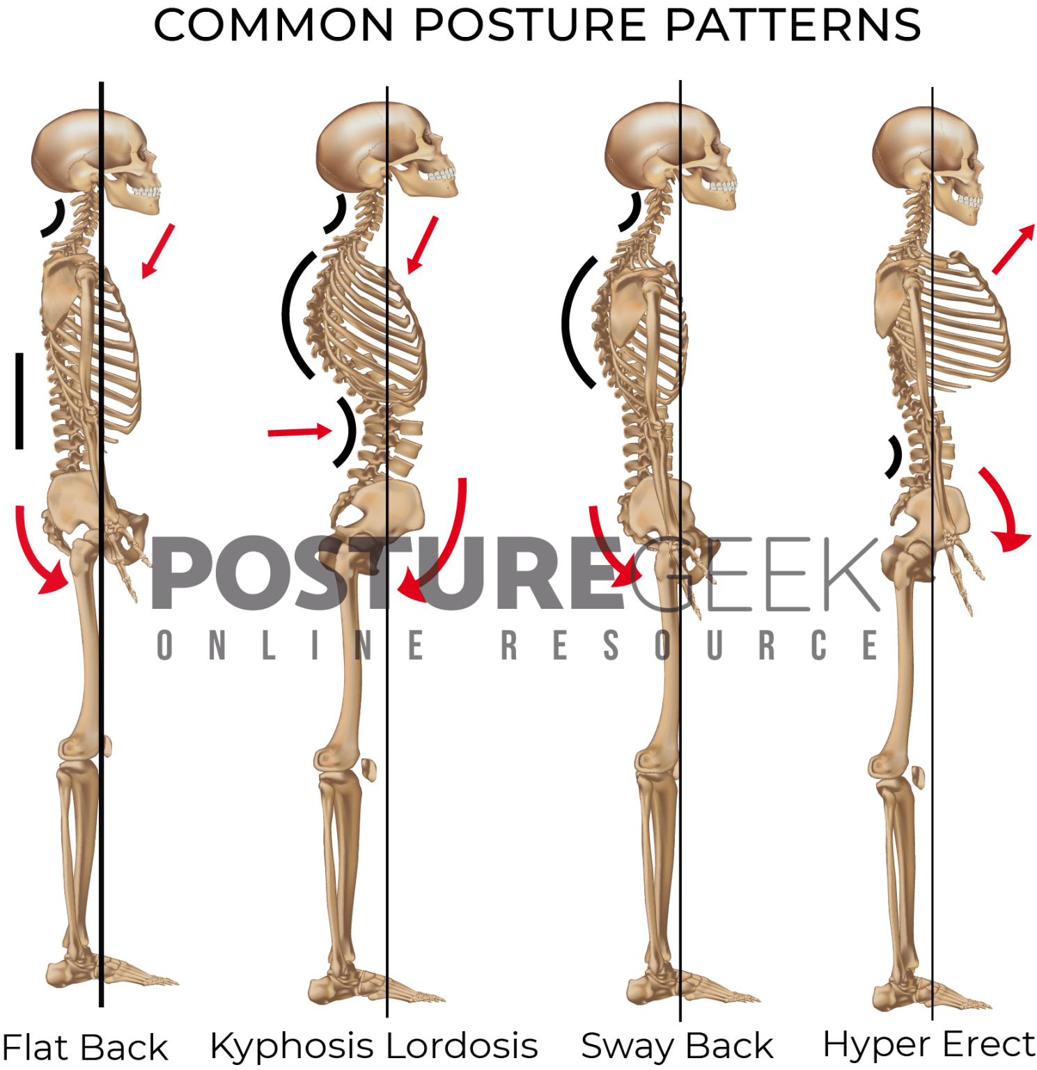 Different Types Of Posture And You | PostureGeek.com