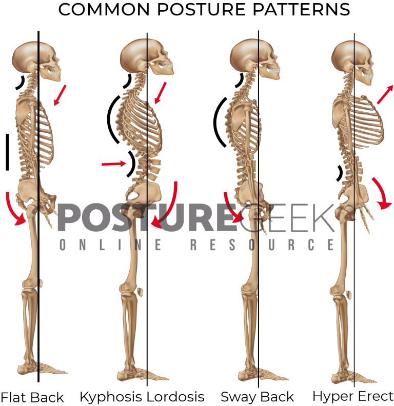 Different Types Of Posture And You | PostureGeek.com