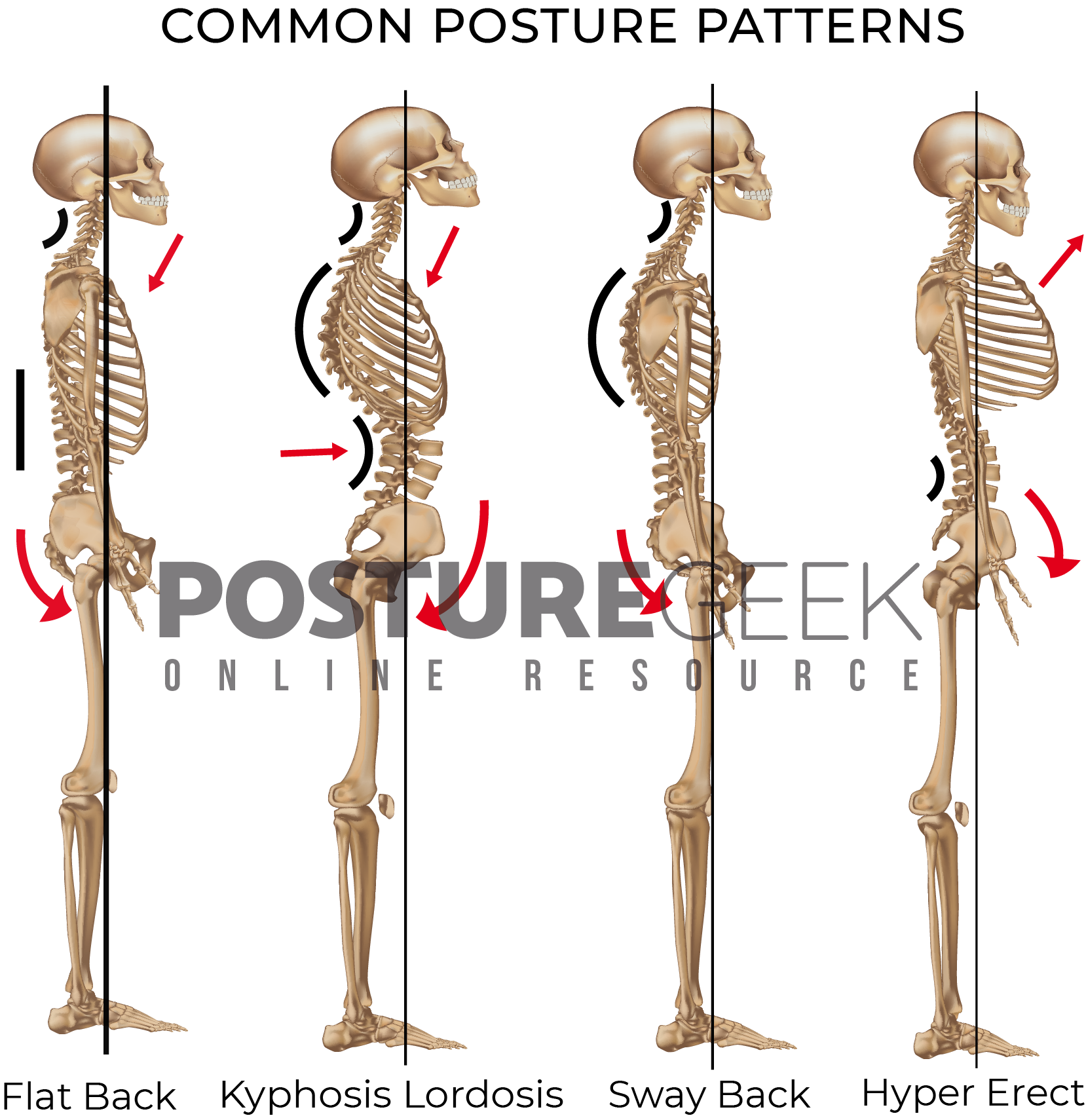 Different Types Of Posture And You | PostureGeek.com