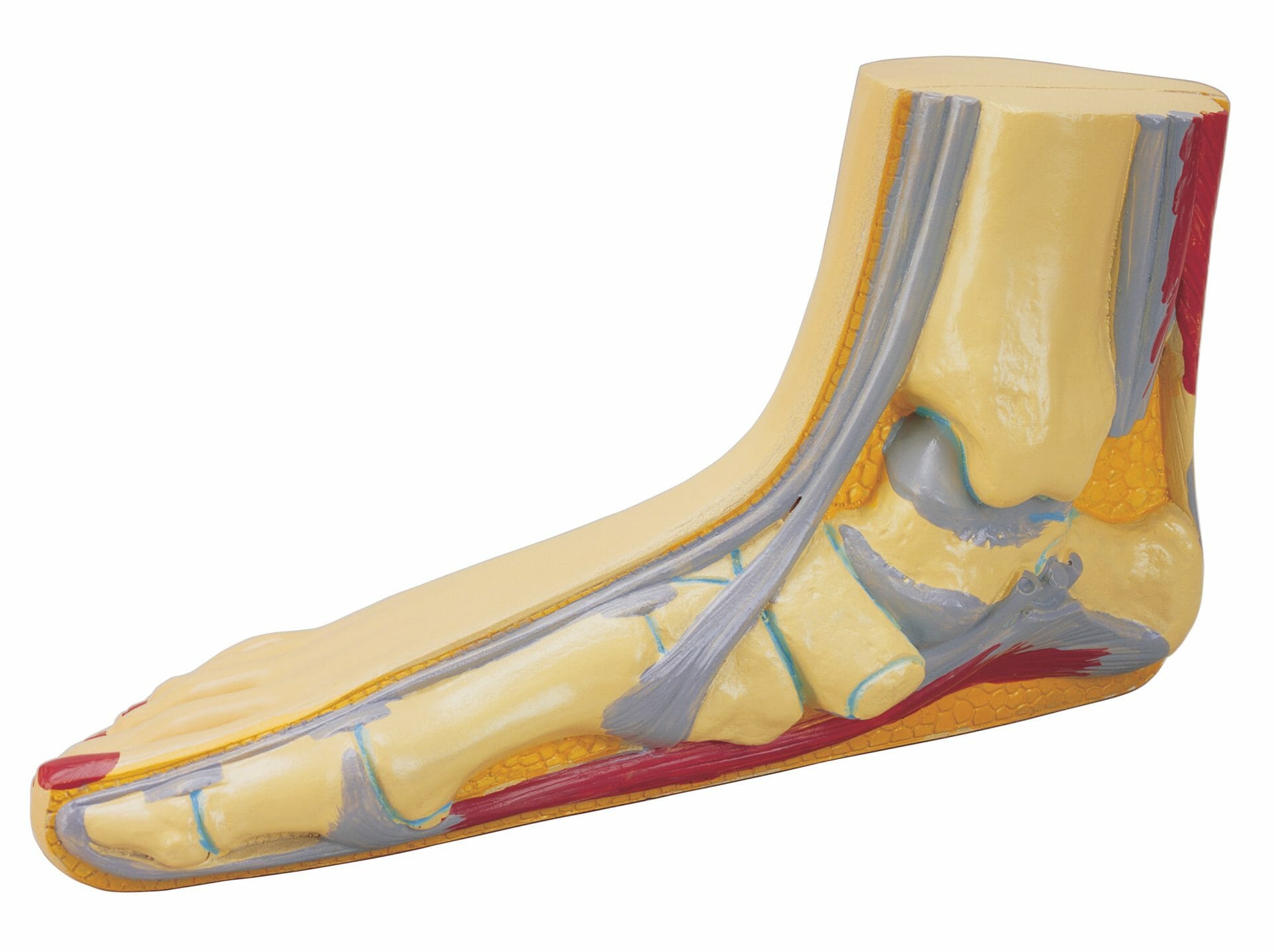 Flat Feet: Symptoms, Diagnosis, And Treatment