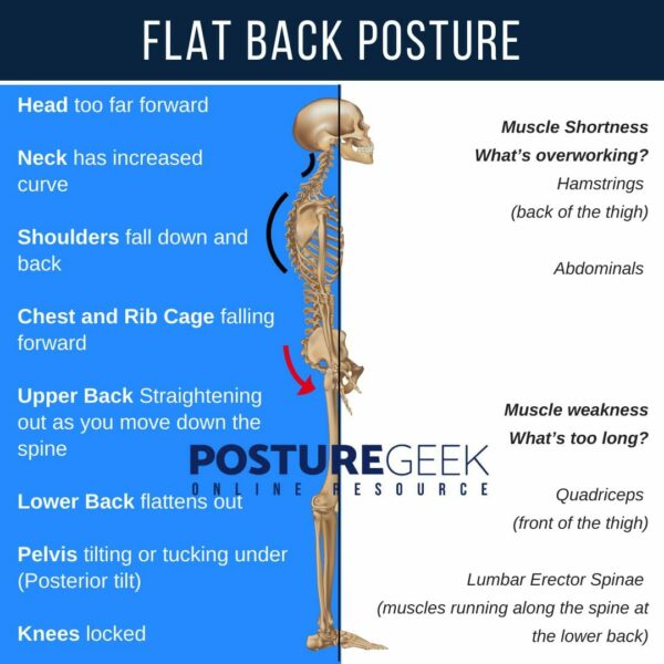 How To Know You Have Flat Back Posture | PostureGeek.com