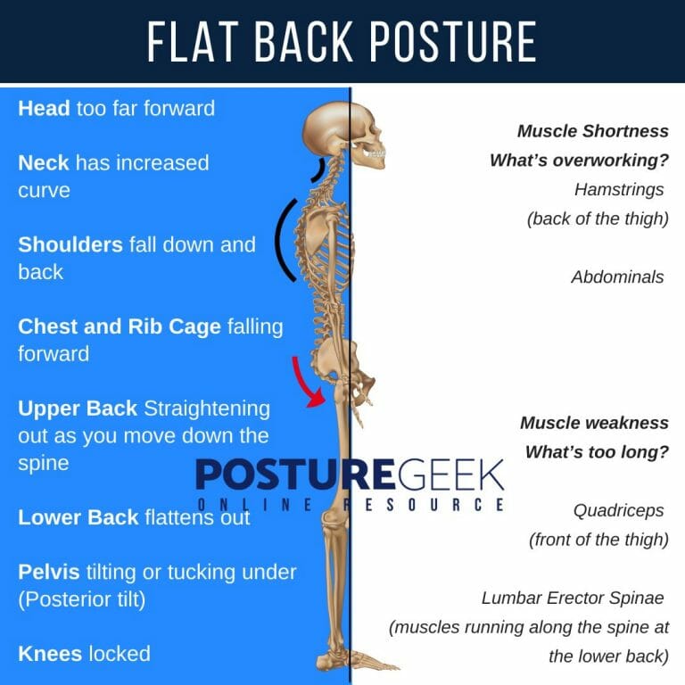 How To Know You Have Flat Back Posture | PostureGeek.com