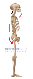 How To Know You Have Flat Back Posture | PostureGeek.com
