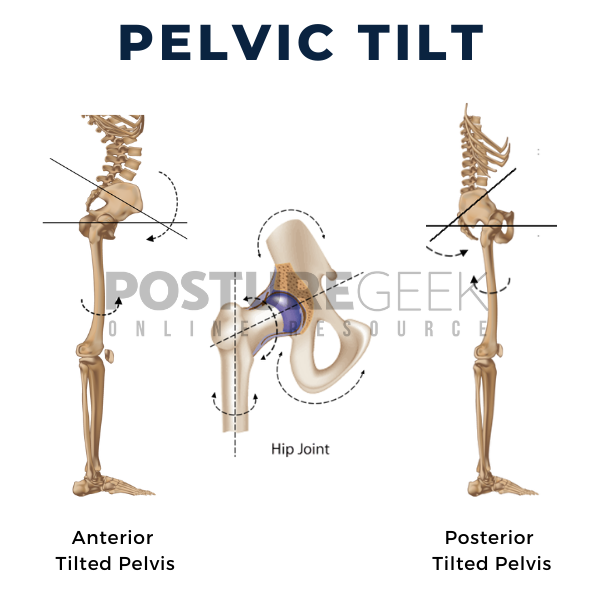 Pelvic Tilt: a guide of what you need to know. - POSTURE GEEK