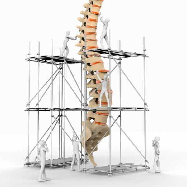 Tensegrity: A Powerful Model for Better Posture | PostureGeek.com