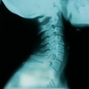 Head and Neck Anatomy: Posture Tips & Key Functions