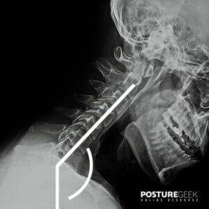 Text Neck: Signs Your Spine Is Out of Line | PostureGeek.com