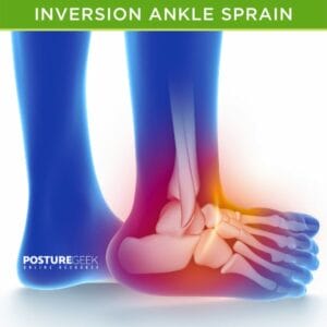 Cuboid Syndrome: Causes, Symptoms, Diagnosis & Treatment