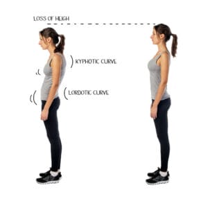 Individual Posture Patterns: The Blueprint of Your Life's Posture