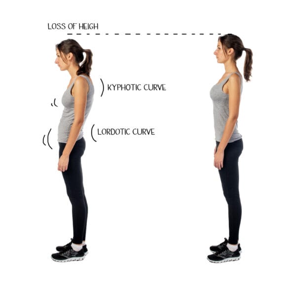 Individual Posture Patterns: The Blueprint of Your Life's Posture
