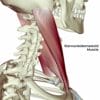 Sternocleidomastoid Muscle: Functions, Disorders, and Care