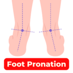 Foot Pronation: Impact on Posture, Movement, and Health