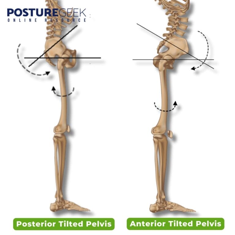 Pelvic Torsion: Causes, Symptoms, and How to Fix It