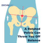 Pelvic Torsion: Causes, Symptoms, and How to Fix It